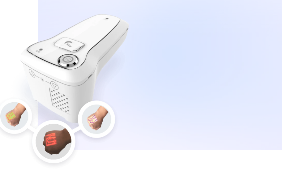 Vein Visualization Using Near Infrared (NIR) Vein Finder | A Detailed Guide